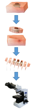 TREATMENT OPTIONS - Surgical and Cosmetic Dermatology